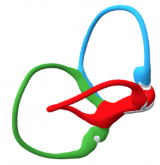 Horizontal Canal BPPV | Vestibular First