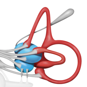 Posterior Canal BPPV | Vestibular First