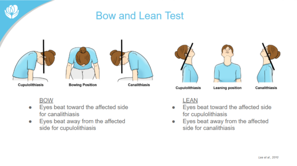 Bow and Lean Test | Vestibular First