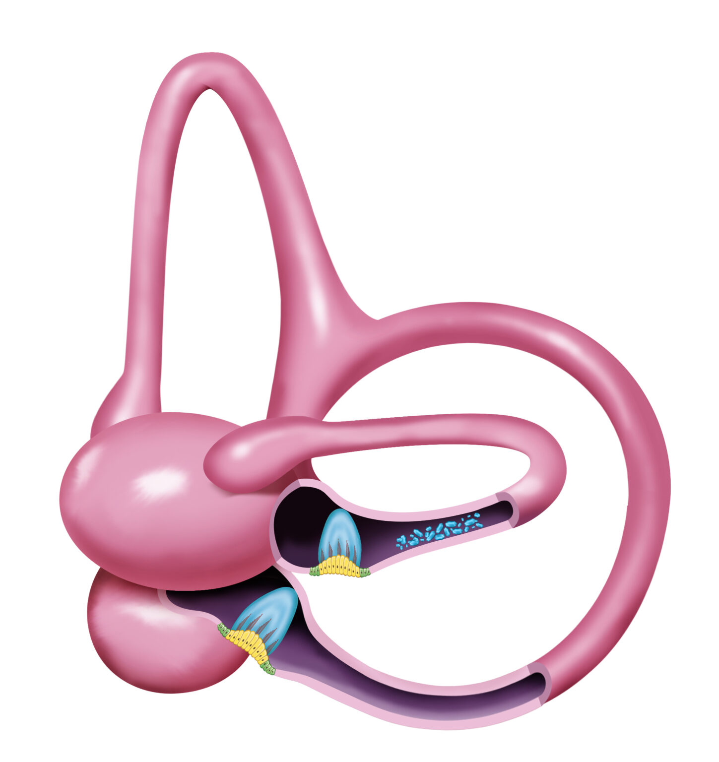 Gufoni Maneuver for Horizontal Canalithiasis | Vestibular First