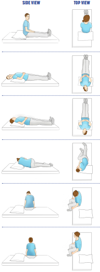 Epley Maneuver | Vestibular First